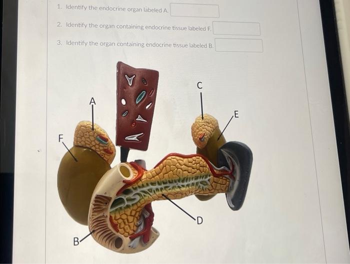 Solved 1. Identify the endocrine organ labeled A 2. Identify | Chegg.com