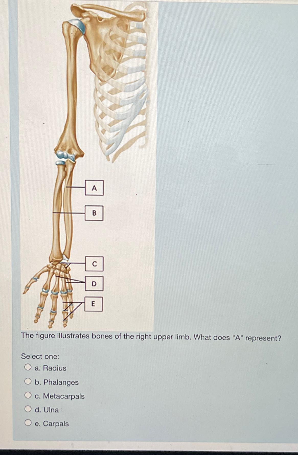 Solved The figure illustrates bones of the right upper limb. | Chegg.com