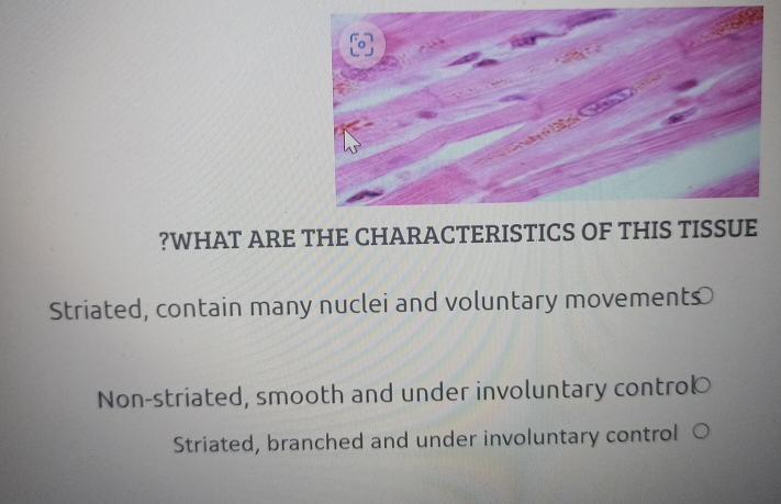 ?WHAT ARE THE CHARACTERISTICS OF THIS TISSUEStriated, | Chegg.com