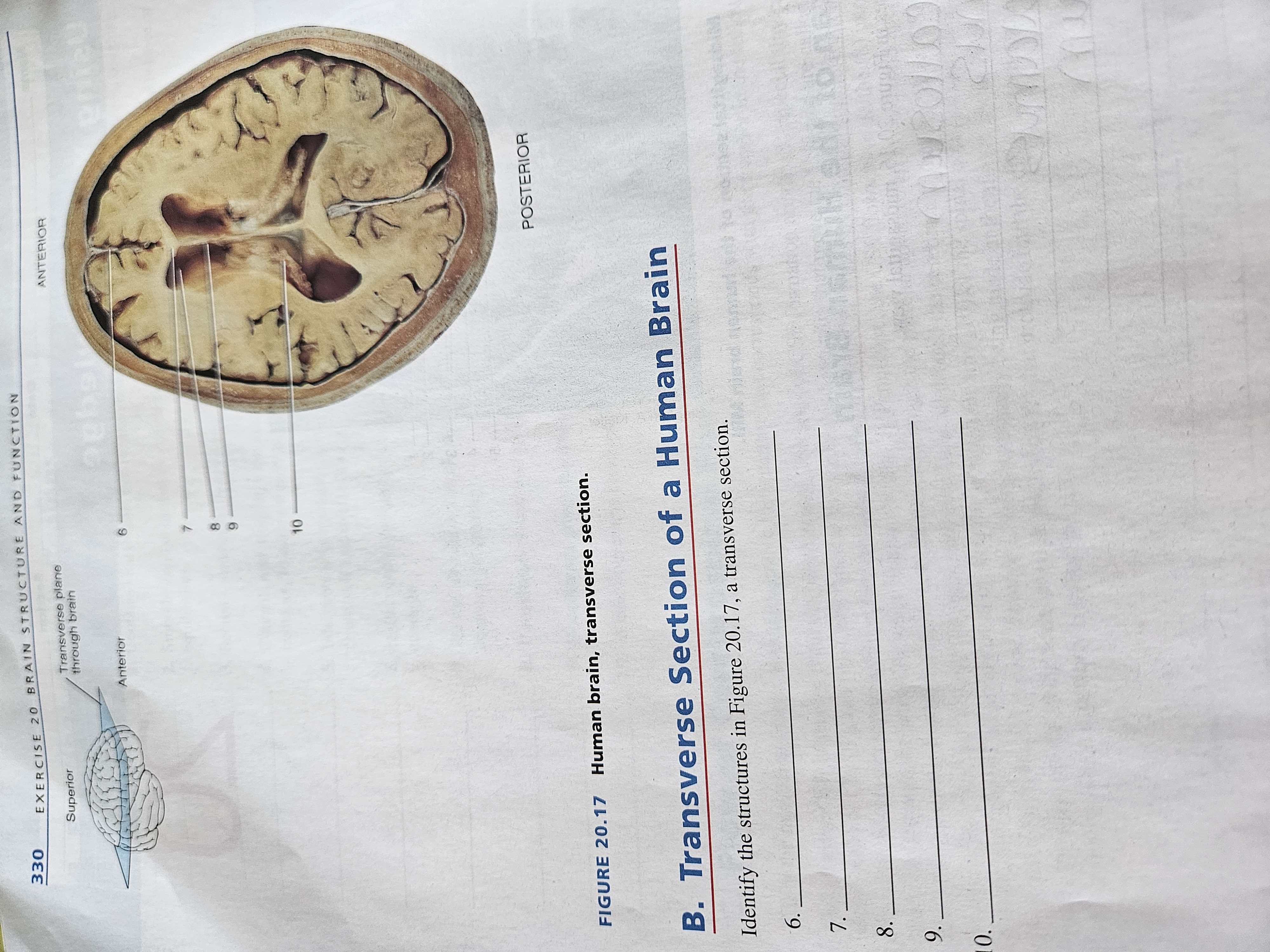 Solved FIGURE 20.17 ﻿Human brain, transverse section.B. | Chegg.com