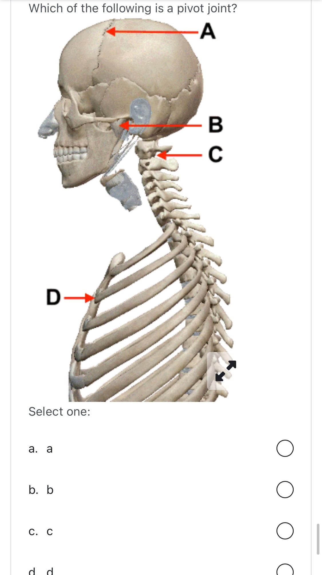 Solved Which of the following is a pivot joint?Select | Chegg.com