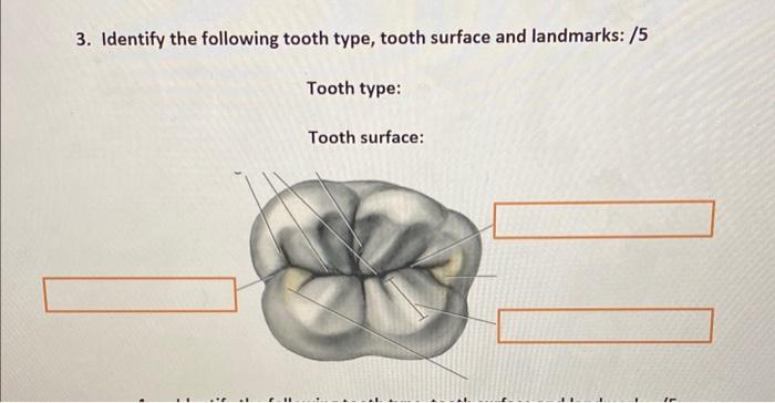 Solved 1. Identify the following tooth type, tooth surface | Chegg.com