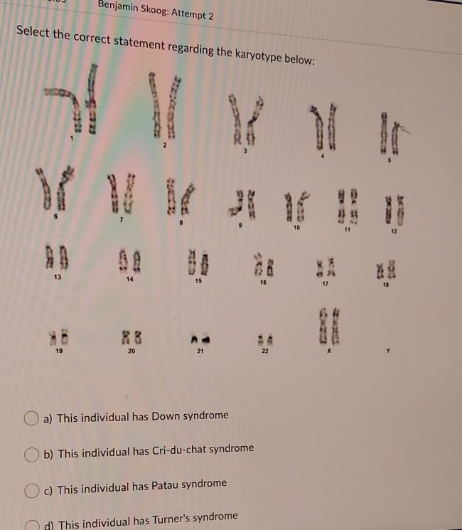 Solved Benjamin Skoog: Attempt 2 Select the correct | Chegg.com