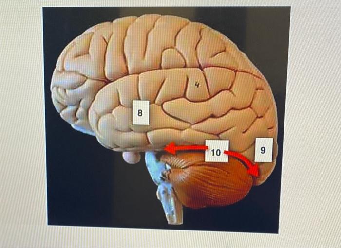 Frontal lobe Lateral sulcus Occipital lobe | Chegg.com