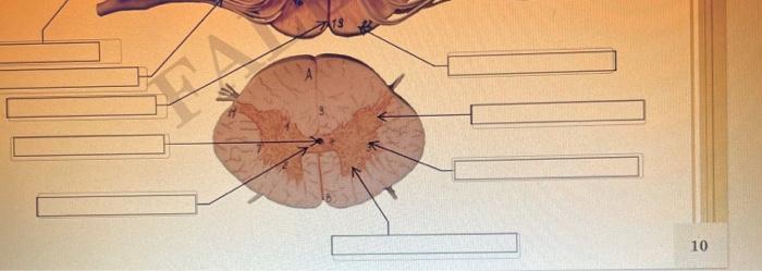 Solved Sign- Label the following: Posterior funiculus, | Chegg.com