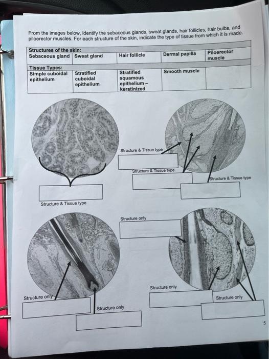 Solved From the images below, identify the sebaceous glands, | Chegg.com