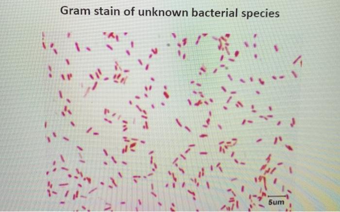 Solved Gram stain of unknown bacterial species IP Sum | Chegg.com