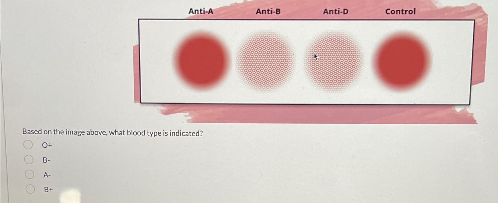 Solved Anti-AAnti-BAnti-DControlBased on the image above, | Chegg.com