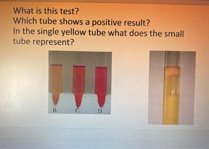 Solved Identify this test. Which tube shows a positive | Chegg.com