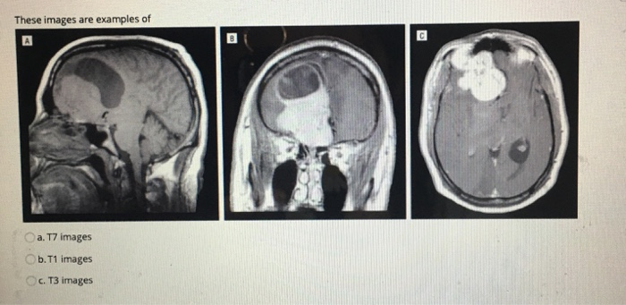 Solved These images are examples of a. T7 images b.T1 images | Chegg.com