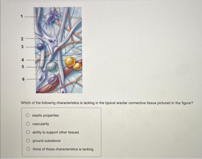 Solved Which of the following characteristics is lacking in | Chegg.com