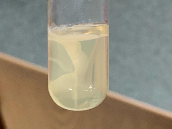 Solved Motility Test Would this be considered Motile or | Chegg.com