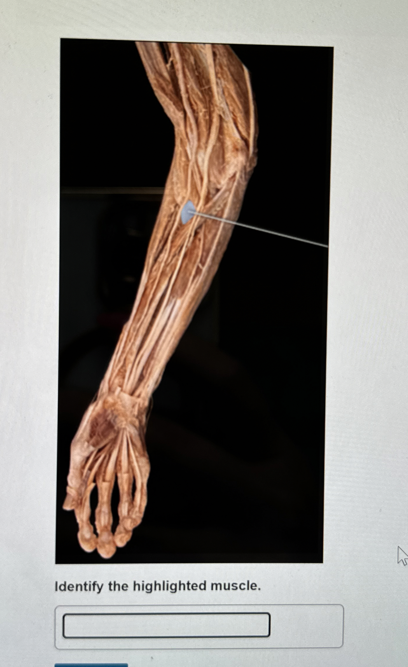 Identify the highlighted muscle. Please help! | Chegg.com