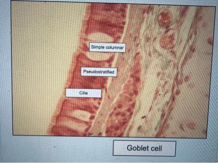Solved Simple columnar Pseudostratified Clila Goblet cell | Chegg.com