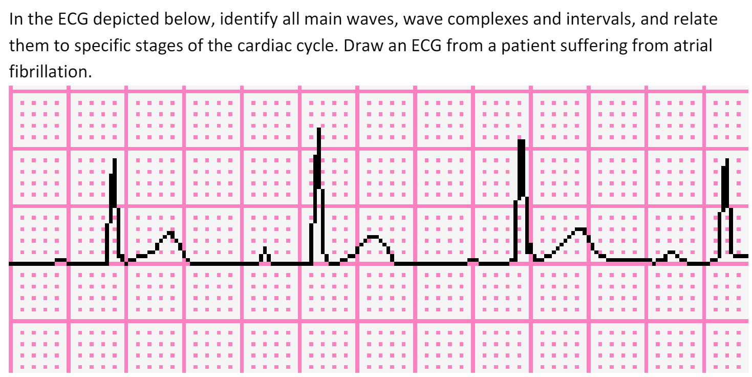 Solved In the ECG depicted below, identify all main waves, | Chegg.com