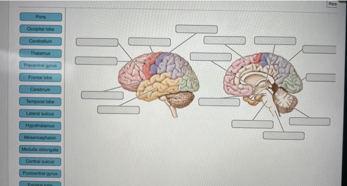Solved Pons Occipital lobe Cerebellum Thalamus Precentral | Chegg.com
