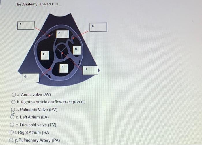 Solved The Anatomy labeled E is a. Aortic valve (AV) b. | Chegg.com