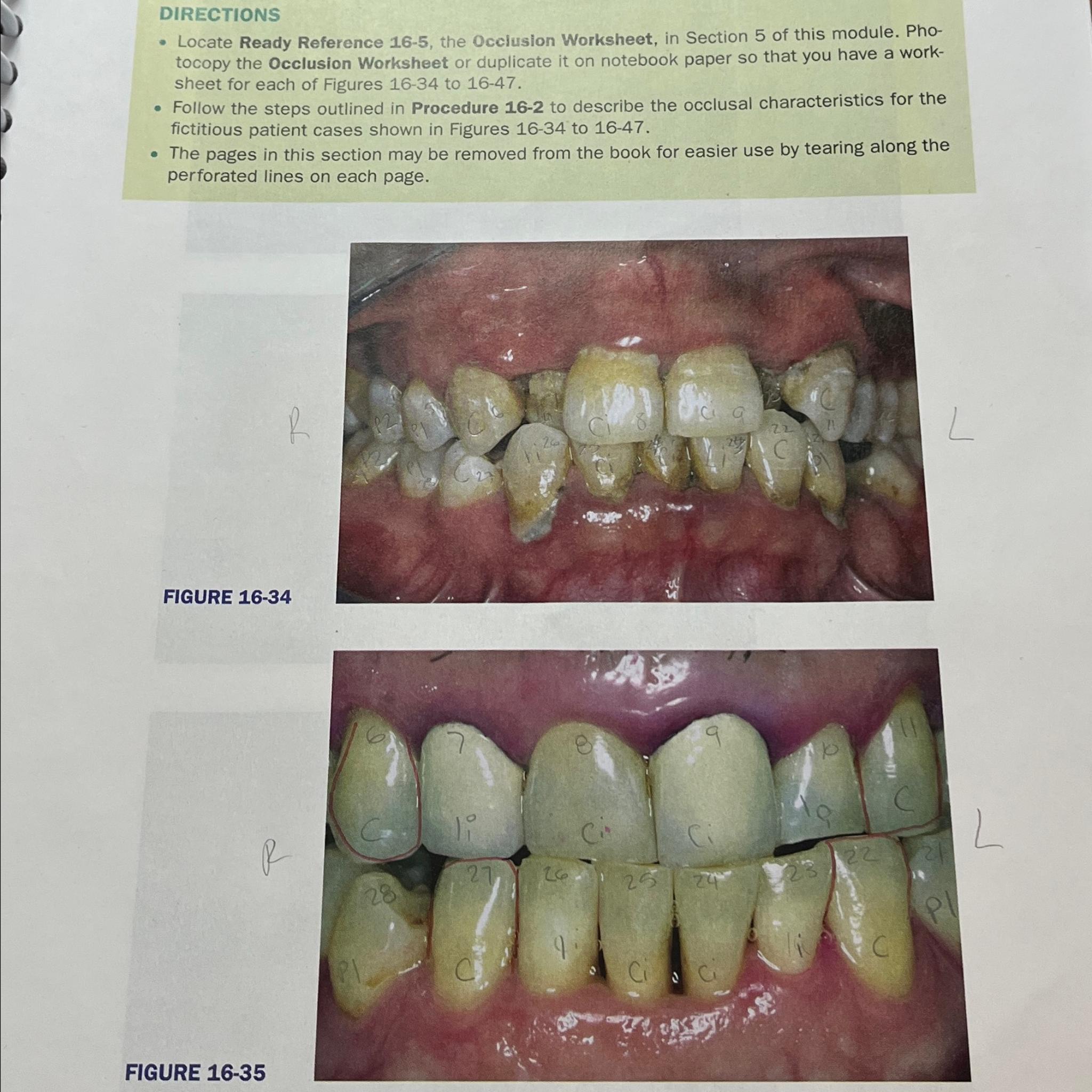 Solved DIRECTIONSLocate Ready Reference 16-5, ﻿the Occlusion | Chegg.com