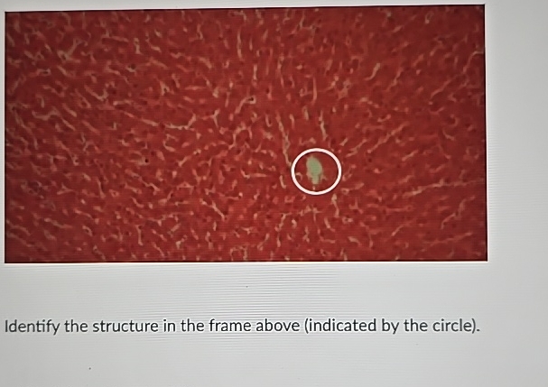 Solved Identify the structure in the frame above (indicated | Chegg.com