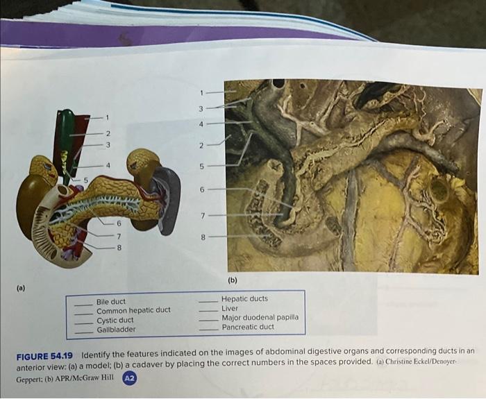 Solved (a) (b) FIGURE 54.19 Identify the features indicated | Chegg.com