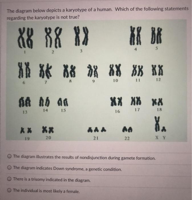 Solved The diagram below depicts a karyotype of a human. | Chegg.com