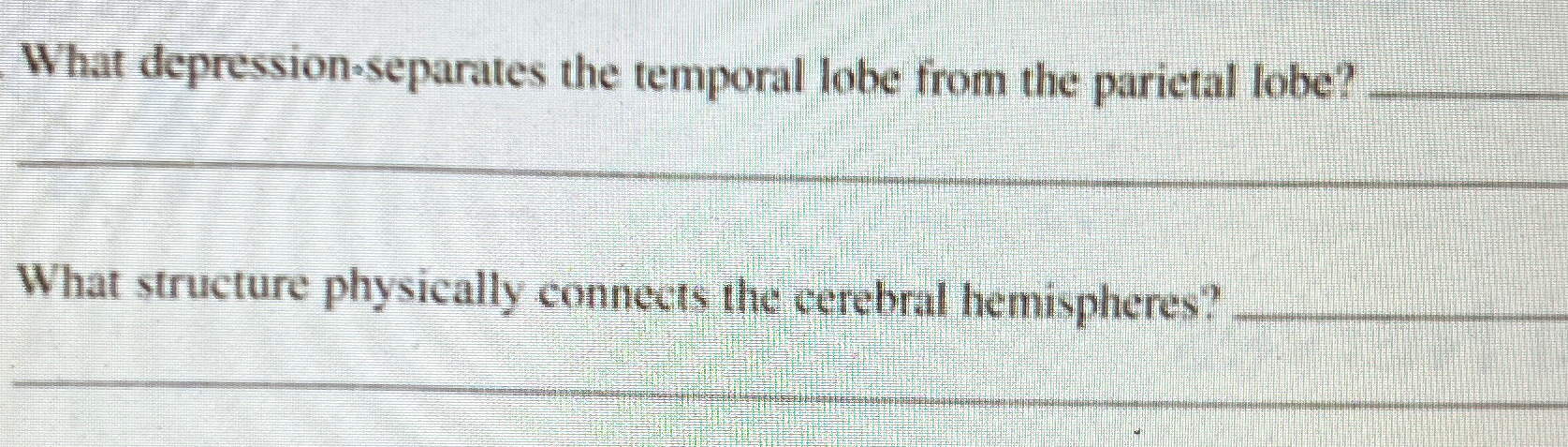 Solved What depression-separates the temporal lobe from the | Chegg.com