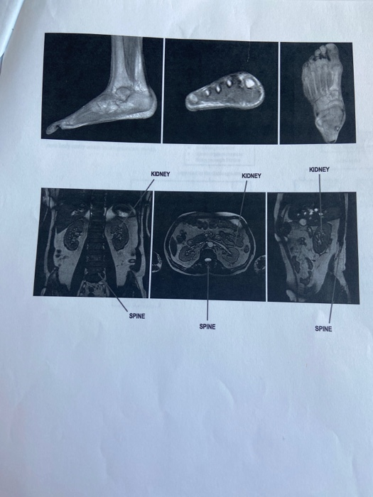 Solved Part II - Examine the MRI images, and label which | Chegg.com