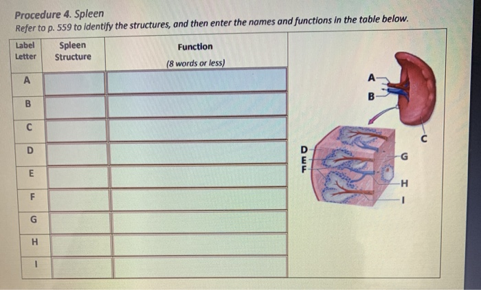 Solved Procedure 4. Spleen Refer to p. 559 to identify the | Chegg.com
