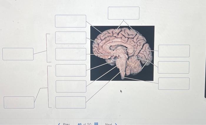 Solved Identify the features on this sagittal (median) | Chegg.com