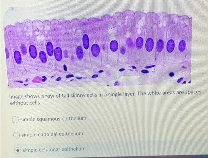 Solved Image shows a circular formation of cells in a single | Chegg.com