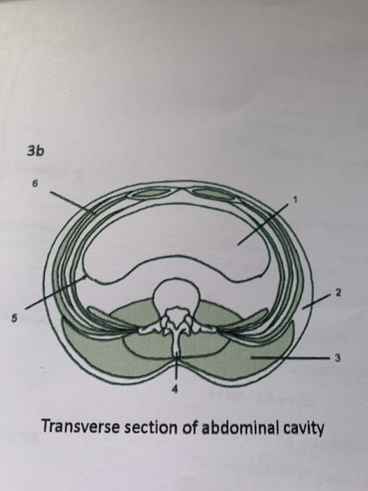 Solved 3b 2. 3 Transverse section of abdominal cavity | Chegg.com