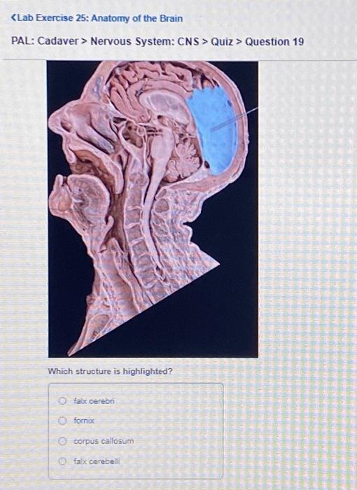 Solved Nervous System: CNS > Quiz > Question 19 Which | Chegg.com