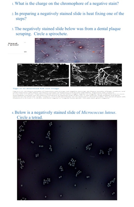 Micrococcus Luteus Negative Stain