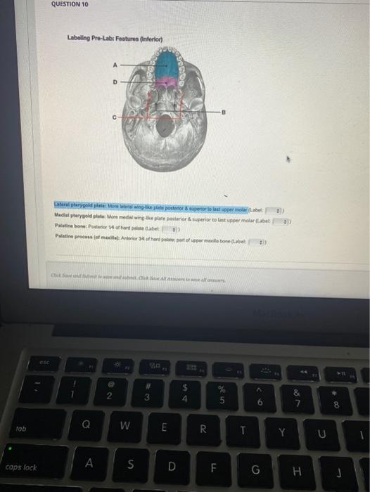 Solved QUESTION 7 Labeling Pre-Lab: Features of Cranial | Chegg.com
