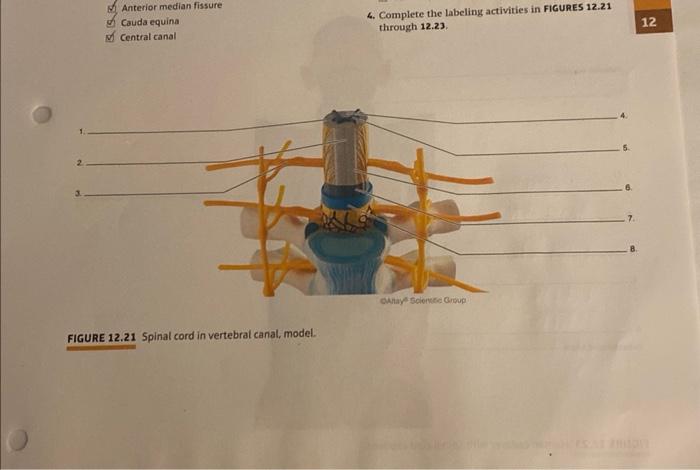 Solved 19. Anterior median fissure 4. Complete the labeling | Chegg.com