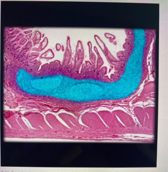 Solved Whats highlighted?dorsal artery, lateral malleolar | Chegg.com