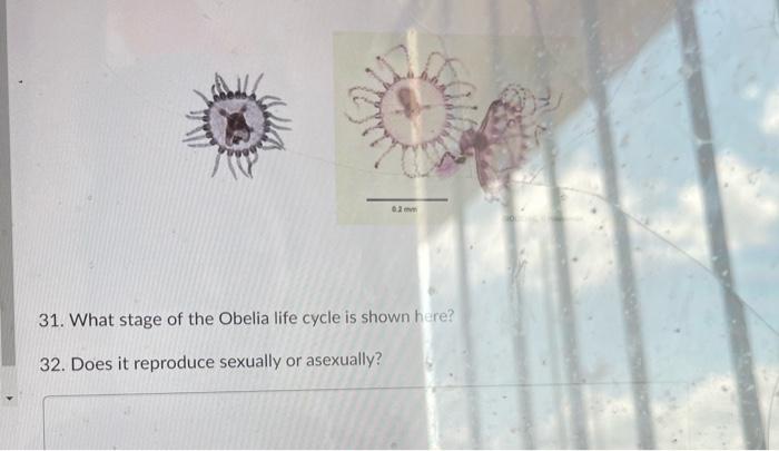 [Solved]: 31. What stage of the Obelia life cycle is shown