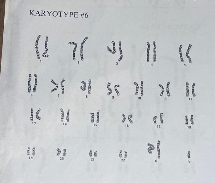 KARYOTYPE \#6 | Chegg.com