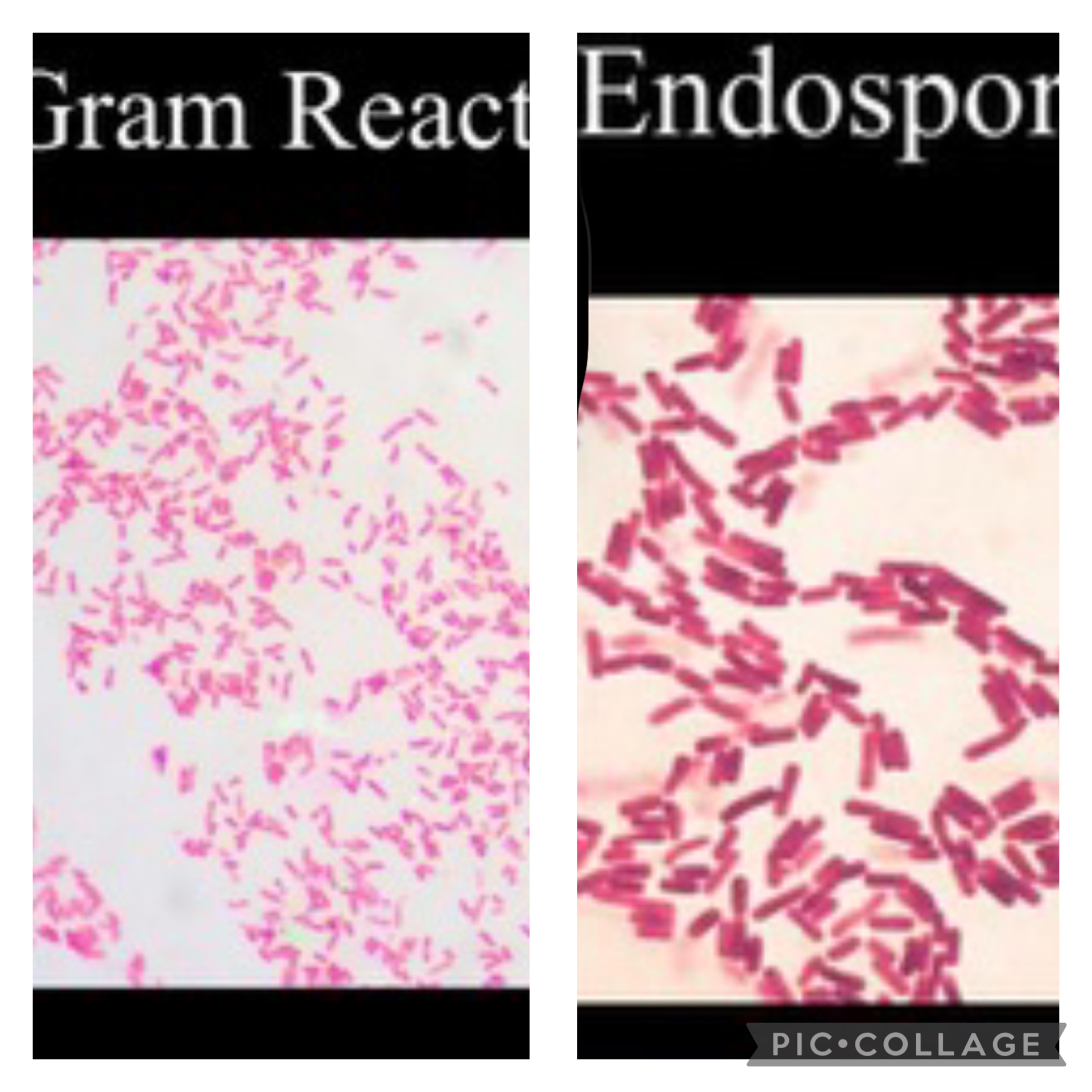 Solved What is the organism to this picture gram reaction | Chegg.com