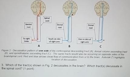 Solved ABFigure 2- ﻿Decussation pattem of ane side of the | Chegg.com