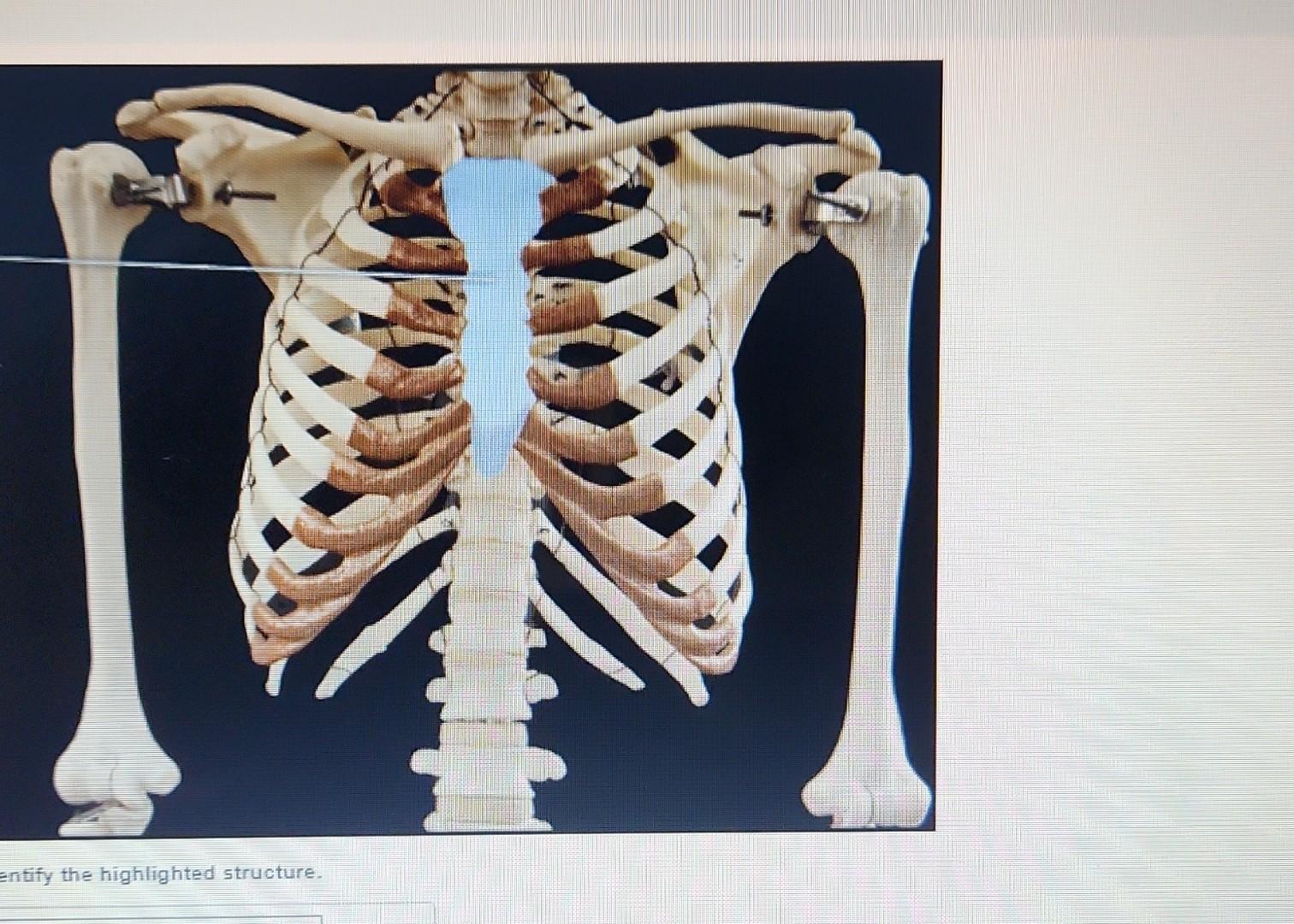 [Solved]: identify the highlighted structure entify th