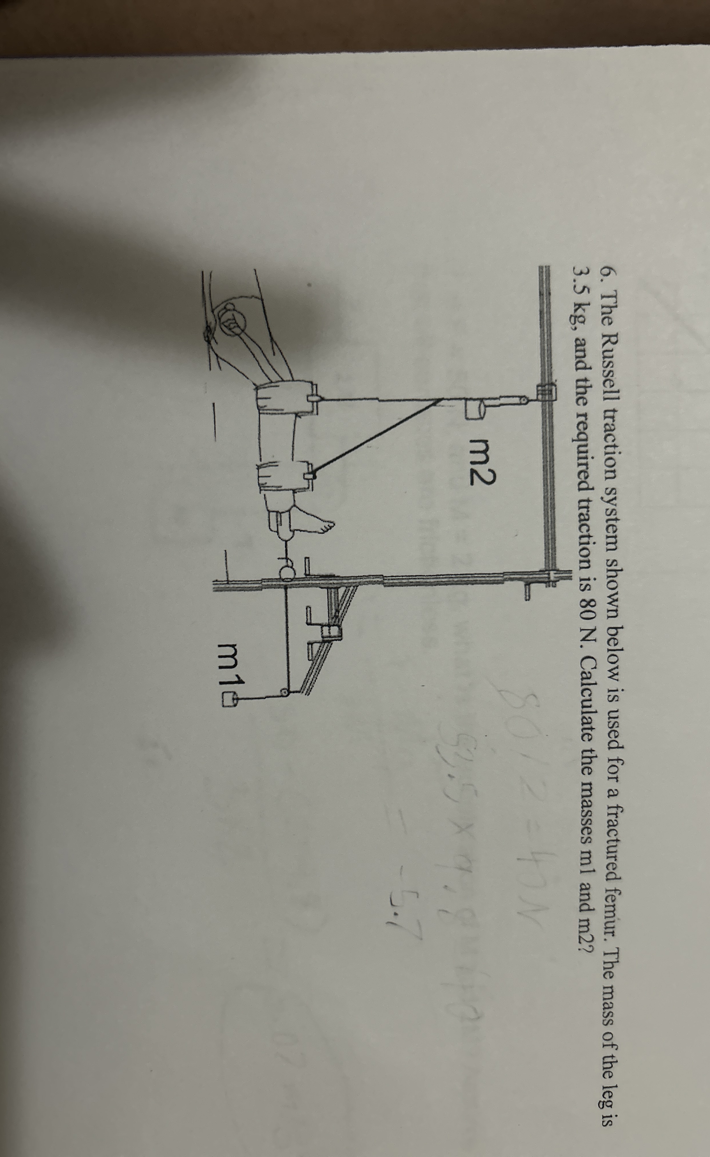 Solved The Russell traction system shown below is used for a | Chegg.com