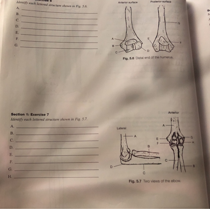 Solved Anterior surface Posterior surface Identify each | Chegg.com