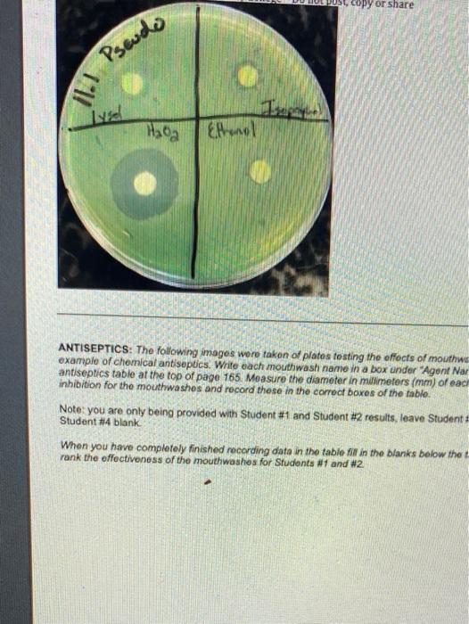 Solved Antisepties Diameter of Zones of inhibition in | Chegg.com
