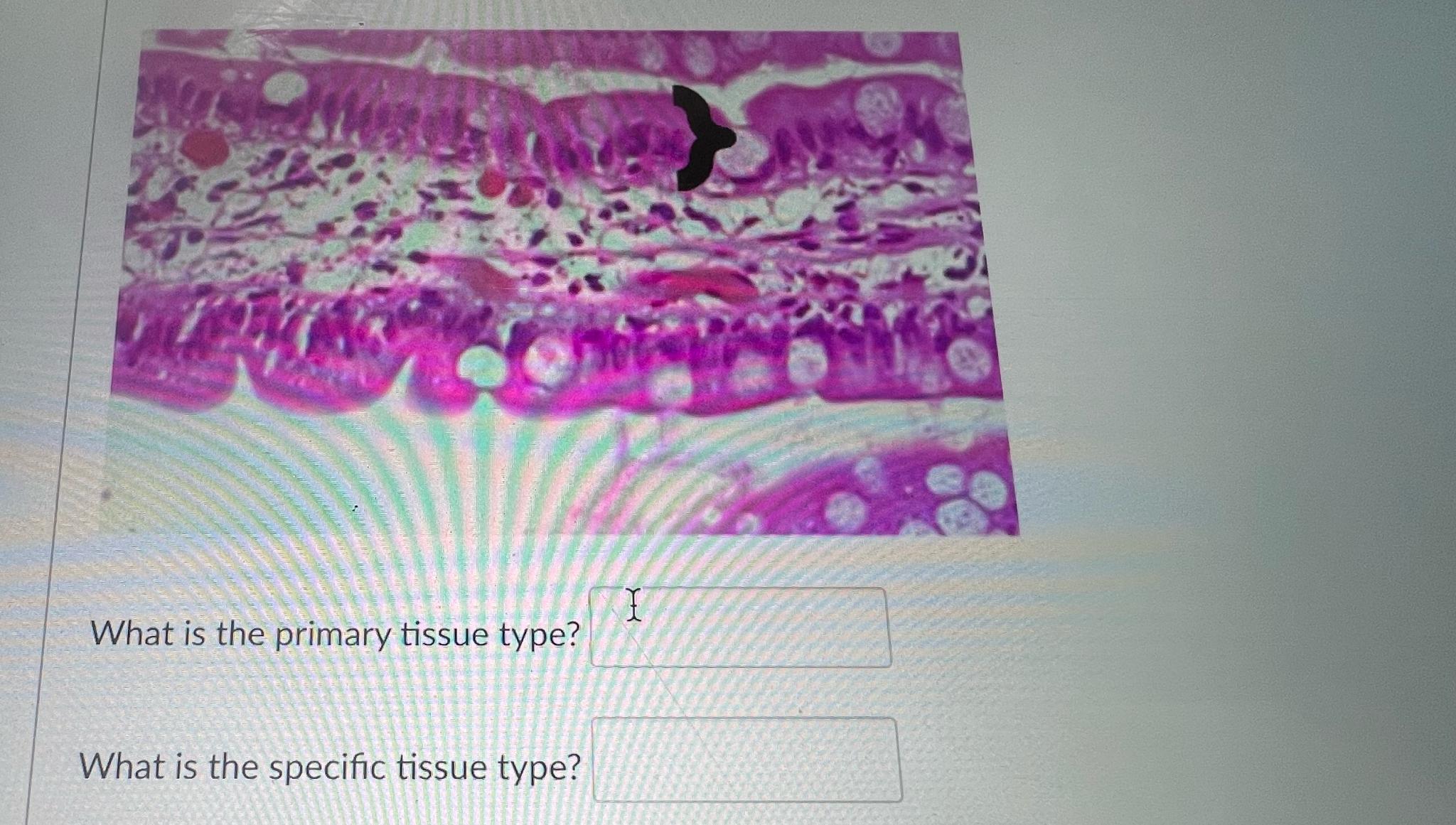 Solved What is the primary tissue type?What is the specific | Chegg.com