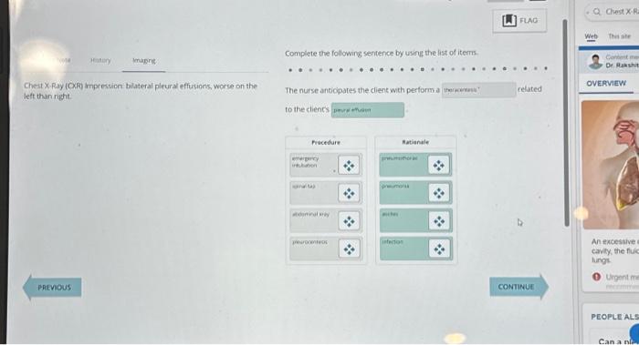 Solved Note History PREVIOUS Imaging Chest X-Ray (CXR) | Chegg.com