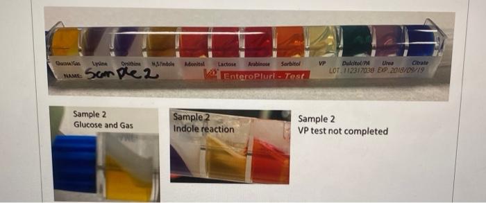 Solved Find code for sample in Enterotube These are the | Chegg.com