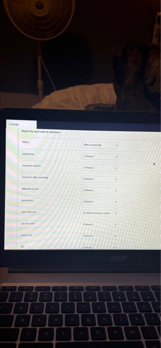 Solved Canvas esc Match the term with its definition OCPs | Chegg.com