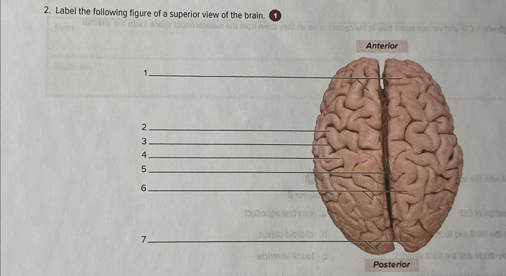 Solved Label the following figure of a superior view of the | Chegg.com