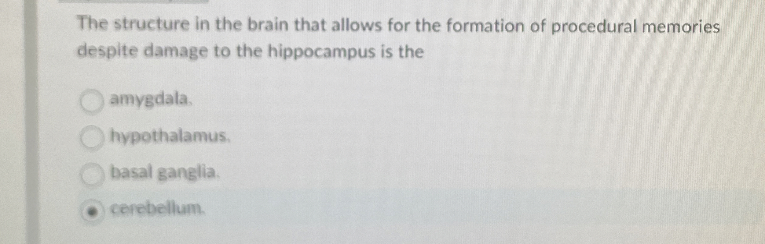 Solved The structure in the brain that allows for the | Chegg.com
